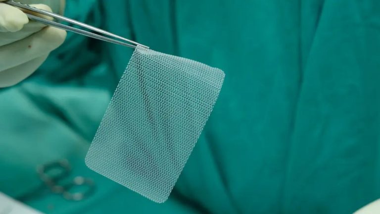 Hernia Repair Surgery With Mesh: Understanding Types & Benefits